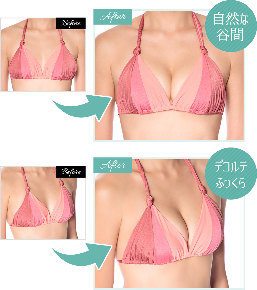 【水着用】ヌーブラ・ビーチ モア｜ヌーブラ公式通販